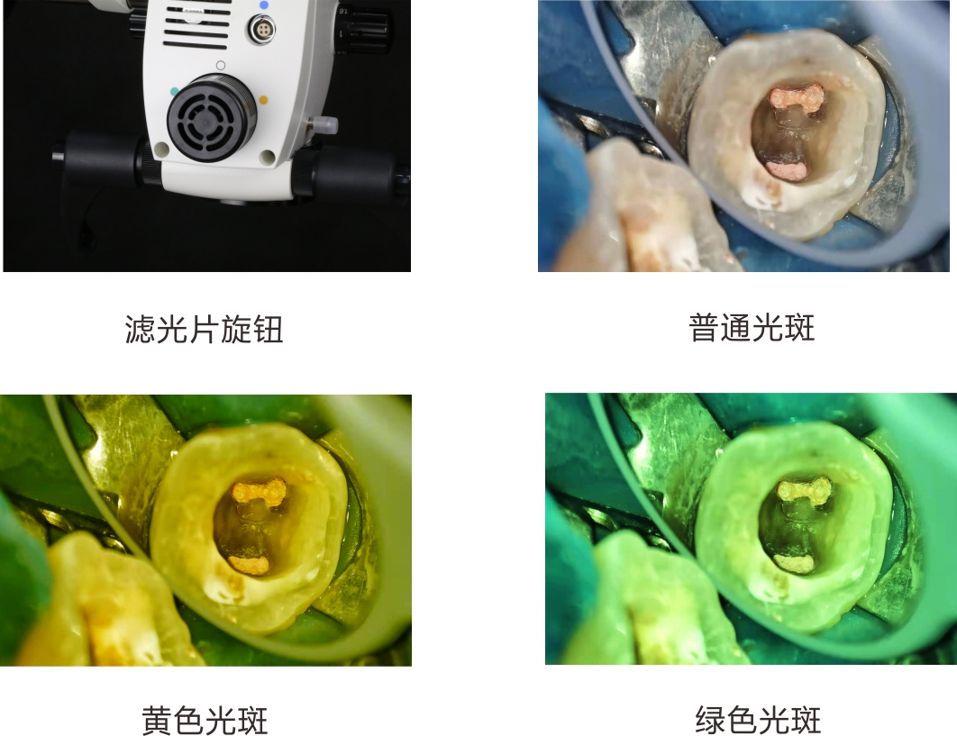 OMS2380手术显微镜 - 苏州速迈医学科技股份有限公司